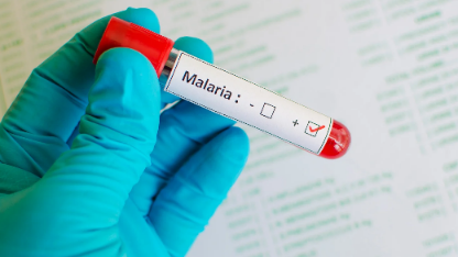 Dinkes Target 1 Juta Tes Malaria, Klaim Positivity Rate Turun di Angka ...